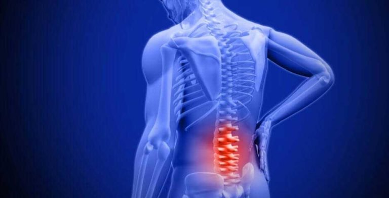 What Are the Most Common Orthopedic Problems? - Ecomuch